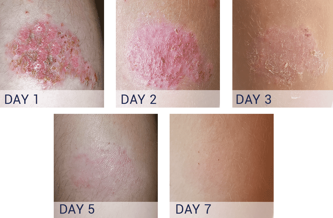 Our technology - Preventogen